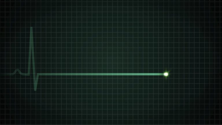 Graph Flatline EKG | Global Trade Review (GTR)